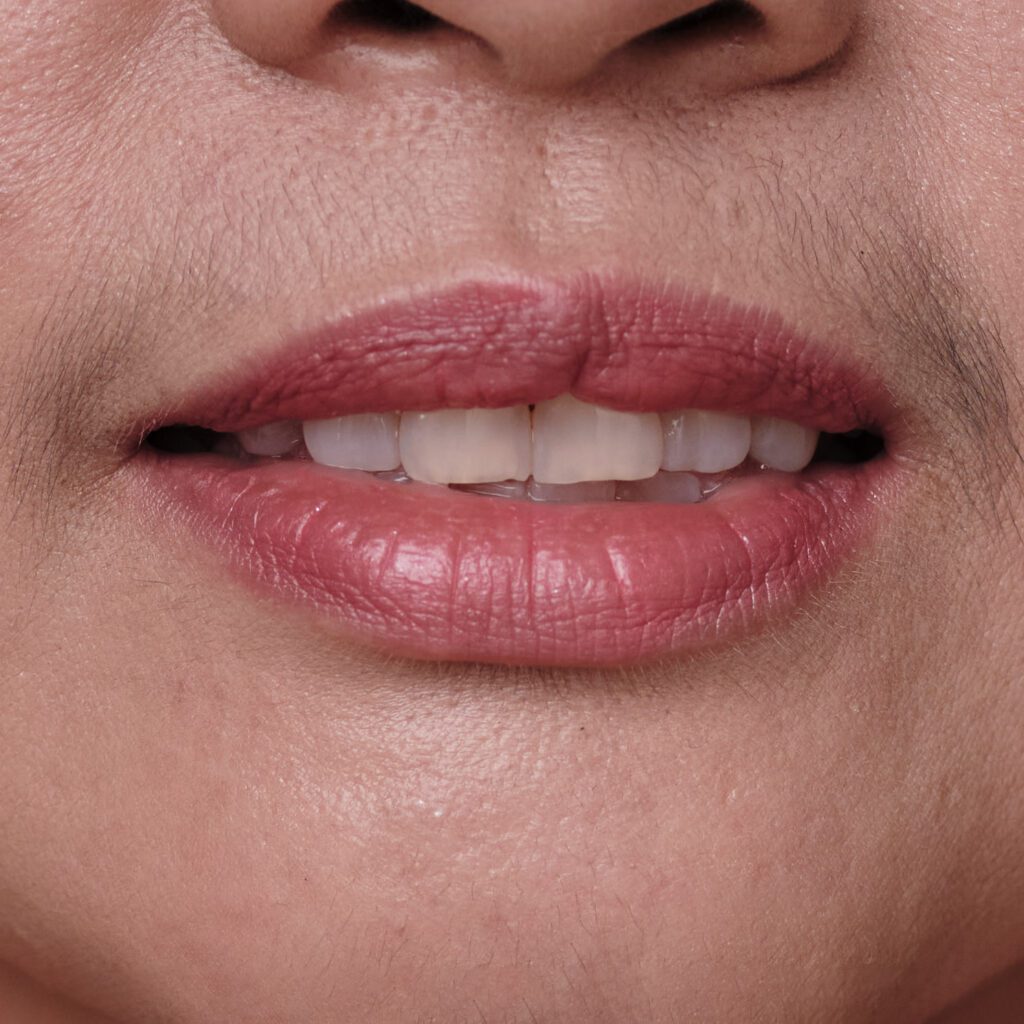 Lip Hair Mustache