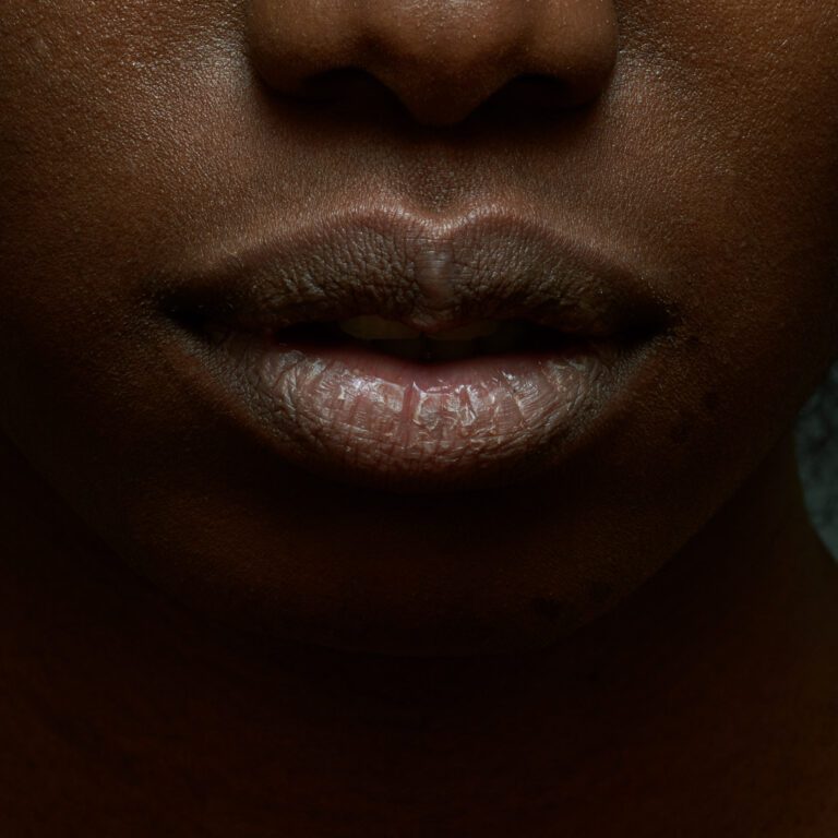 Lips